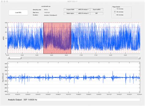 Neonatal EEG Analysis Toolbox NEAT Neonatal Neurology Physiology Research Lab Washington