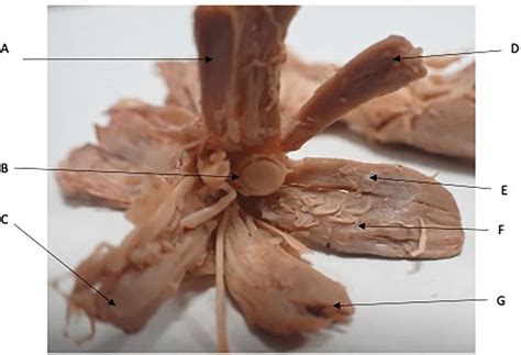 Major F And Minor E Head Of The Medial Rectus A Superior Rectus Download Scientific
