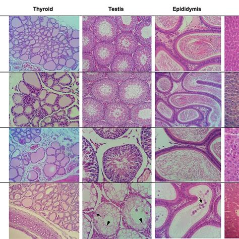 Histopathological Assessment Of Thyroid Testis Epididymis And Liver Download Scientific