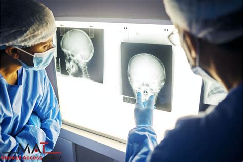 market access today on linkedin prevalence of sftsv rna in humans