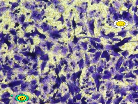 细胞迁移实验：10个关键步骤详解