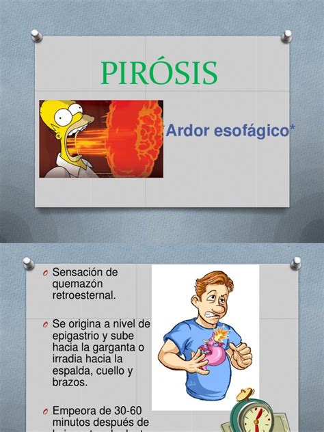 Definición Y Causas De La Pirosis Pdf