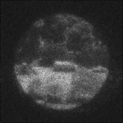 Direct Detection Synthetic Aperture Coherent Imaging By Phase Retrieval