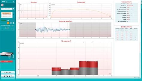 Top 10 Eclipse Features
