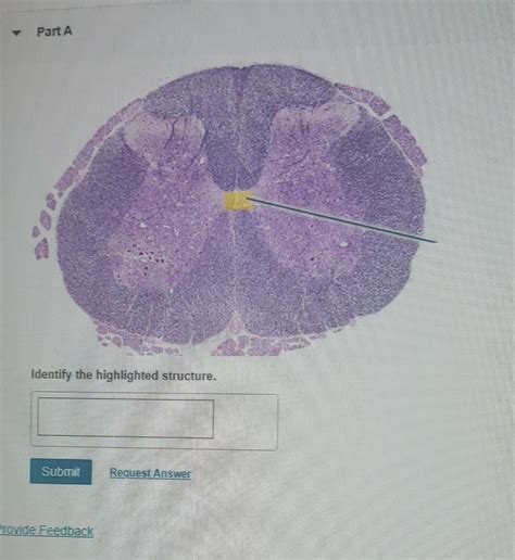 Solved Identify The Highlighted Structures Identify The