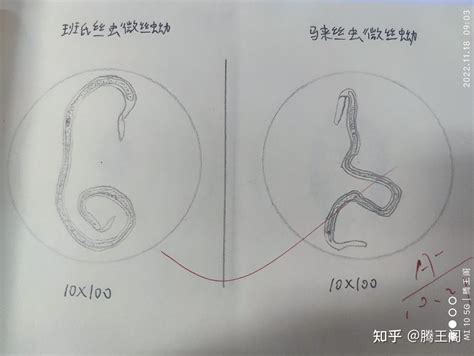 人体寄生虫学实验画图作业——手绘图 知乎