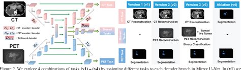 Figure 1 From Mirror U Net Marrying Multimodal Fission With Multi Task