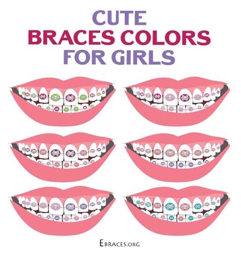 You Don T Have To Be A Genius To Choose Braces Colors