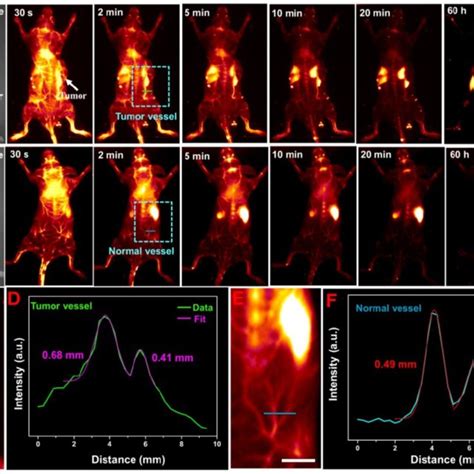 Nir Ii Imaging Guided Tumor Vessel Tracking And Whole Body Vessel