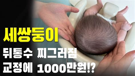 세쌍둥이 전부 다 사두증 ㅣ셀프 두상교정 스트레칭ㅣ두상교정헬맷ㅣ아기 두상 만들기ㅣ3개월 4개월 아가ㅣ현실 육아 24시간ㅣ육아