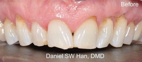 Leesburg Dentist Office Smile Designer Of Leesburg