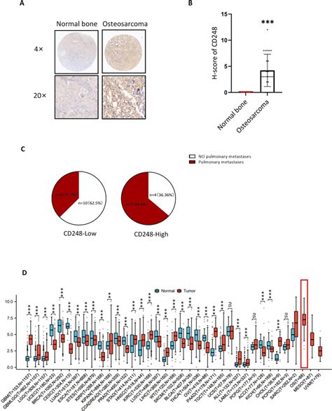 Cd248 Was Highly Expressed In Os Tissues And Was Correlated With