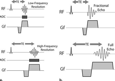 Techniques For Shortening Echo Time Gf Frequency Encoding Gradient