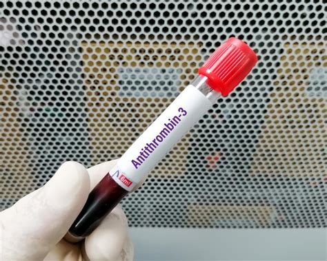 Premium Photo Blood Sample Tube For Antithrombin Iii Test For The