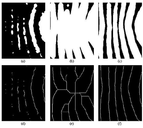 Binarization Results Of Fig 1 And Their Centerline Images A Otsu