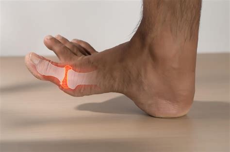 Premium Photo Gout Or Inflammatory Arthritis In A Men High Uric Acid