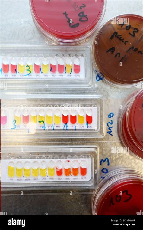 Api Microbiology Test Identifying Bacteria Laboratory Technician Performing An Analytical