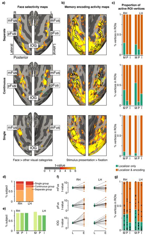 face selectivity and memory encoding activity in ventral temporal