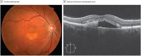 Pin On Patient Information Pages