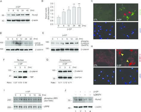 β Gp Stimulates Runx2 Induction And Activates β Catenin Signaling In
