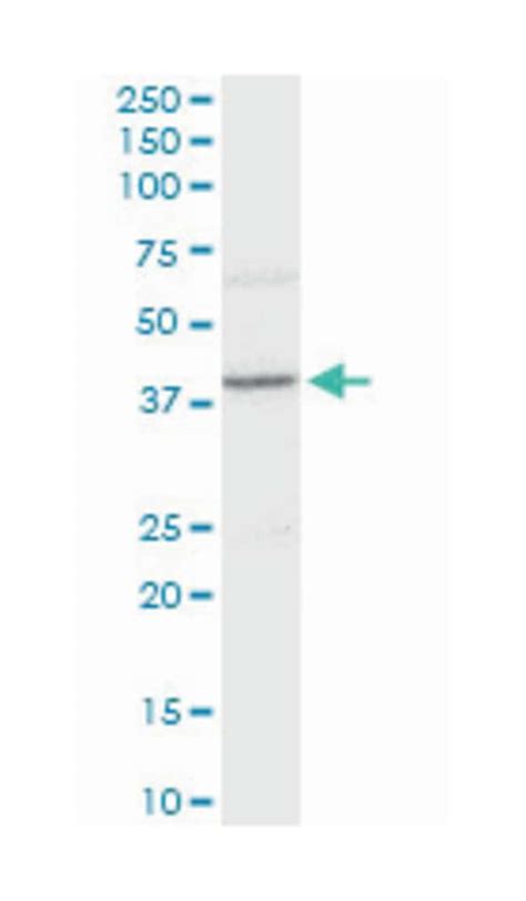 Opioid Receptor Kappa 1 Mouse Polyclonal Antibody Abnova 50μl