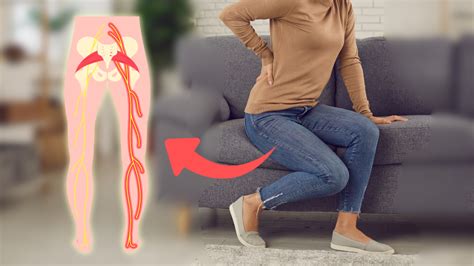 How Long Does Sciatica Last Recovery Timeline Explained Re Lax Chiropractic And Wellness