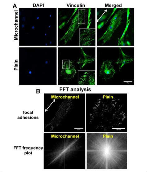 The Spatial Distribution Of Focal Adhesions In Hmscs Cultured