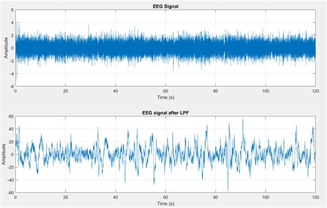 Solved Given The Eeg Signal Below What Could Be The