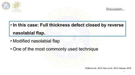 Case Report Nasolabial Flap Nasal Ala Recons With Reverse Nasolabial Flap Following Excision Of