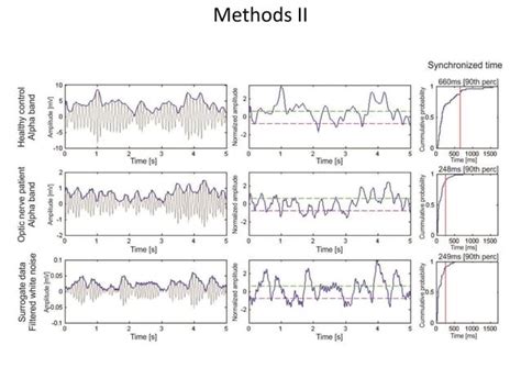 Brain Resting State Activity In Patients With Vision Loss Due To Visual
