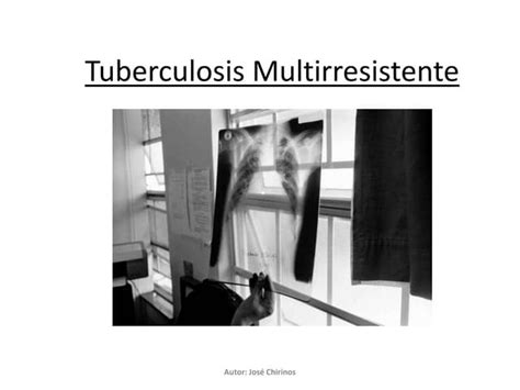 Tuberculosis Multirresistente Pptx
