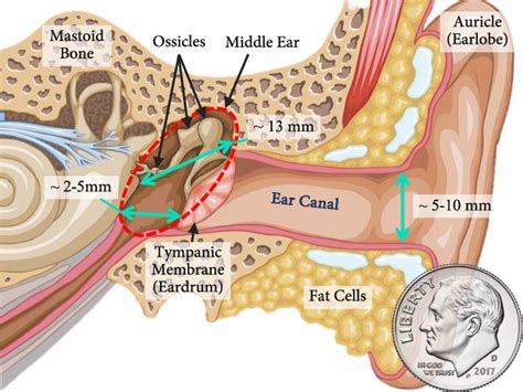 Figure 1 From A Novel Articulating Chip On Tip Endoscope For Dynamic Middle Ear Surgical