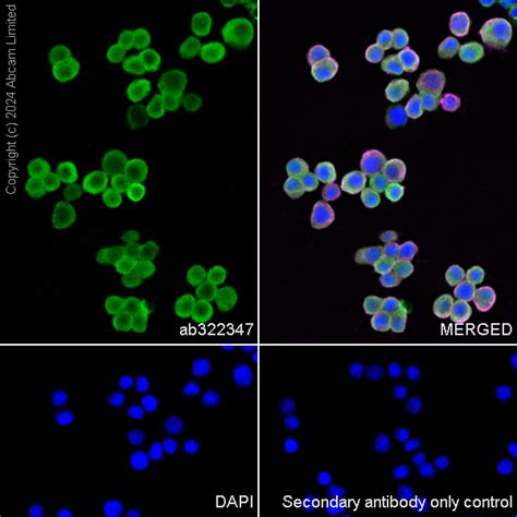 Anti Galectin 1 Galectin 3 Galectin 8 Antibody Rm1261 Ab322347