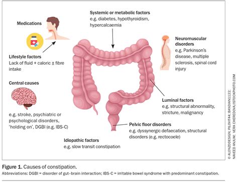 When The Going Gets Tough A Practical Approach To Refractory