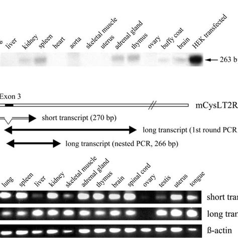 Expression And Alternative Splicing Patterns Of Mcyslt 2 R In Mouse Download Scientific Diagram