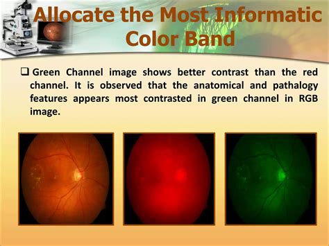 Automatic Detection Of Diabetic Maculopathy From Fundus Images Using Image Analysis Techniques Ppt
