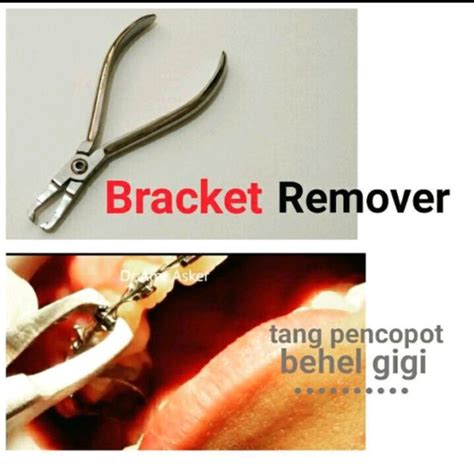 Dental Tang Ortho Bracket Remover Tang Pelepas Behel Lazada Indonesia