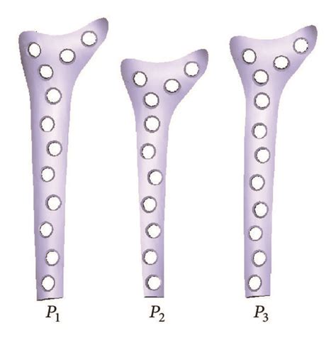 Classified Condylar Buttress Plates Download Scientific Diagram