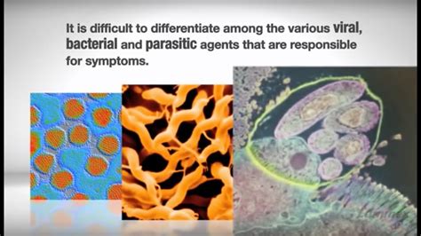 Bacterial Gastrointestinal Pathogen Panel At Jimmie Mireles Blog
