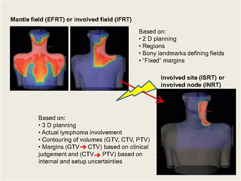 Radiation Fields
