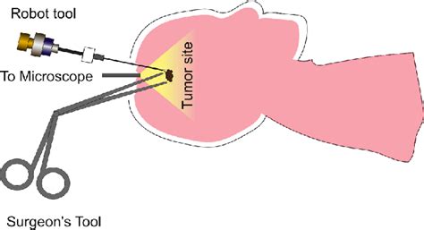 Figure 1 From Robotic And Neurosurgical Instrument Segmentation For