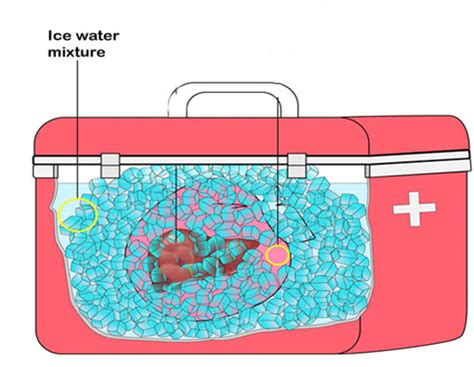 Arduino Medical Projects Updated