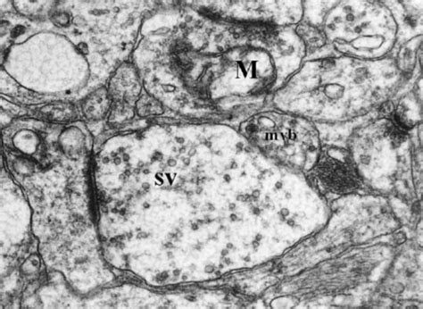 Presynaptic Terminals In Layer Iii Of The Acoustic Cortex Demonstrated Download Scientific