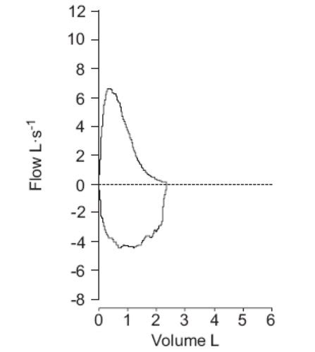Flow Volume Loops Module 2 Flashcards Quizlet