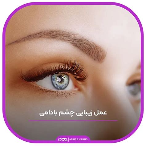 عمل زیبایی چشم کلینیک آتریسا