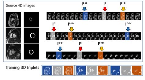1 our strategy to train a segmentation forest from 3d t cardiac data