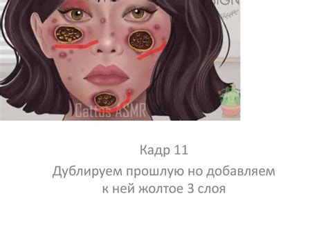 Заболевание глаз презентация онлайн