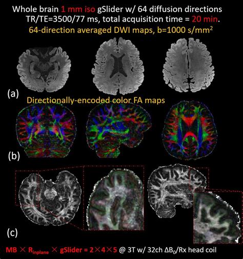 A Averaged Diffusion Weighted Images And B Directionally Encoded Download Scientific