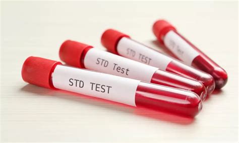How Often Should You Get Std Tested