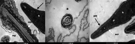 Transmission Electron Microscopy Of Fresh Sperm Structure And